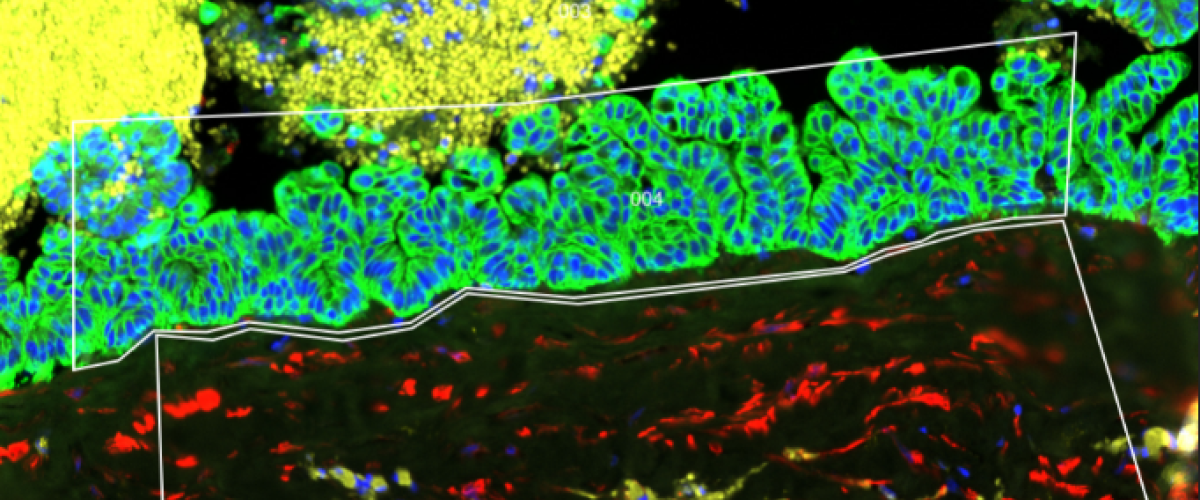 Digital Spatial Profiling | Duke BioRepository & Precision Pathology Center Digital Spatial Profiling | Duke BioRepository & Precision Pathology Center